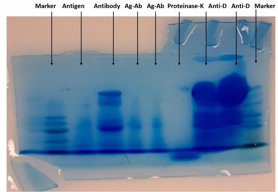 Post | Electrophoretic separation of protein by SDS-PAGE